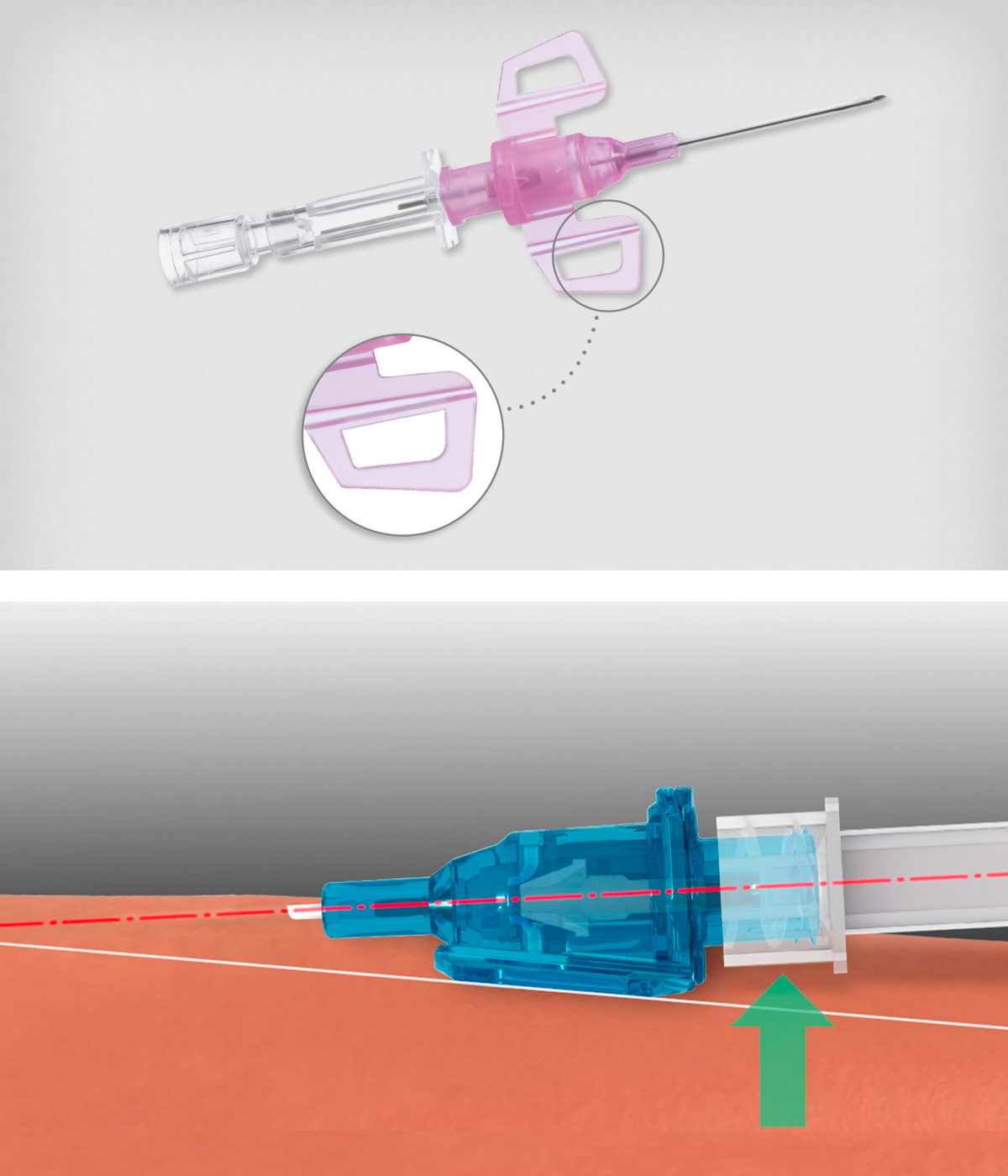 Safe for the patients